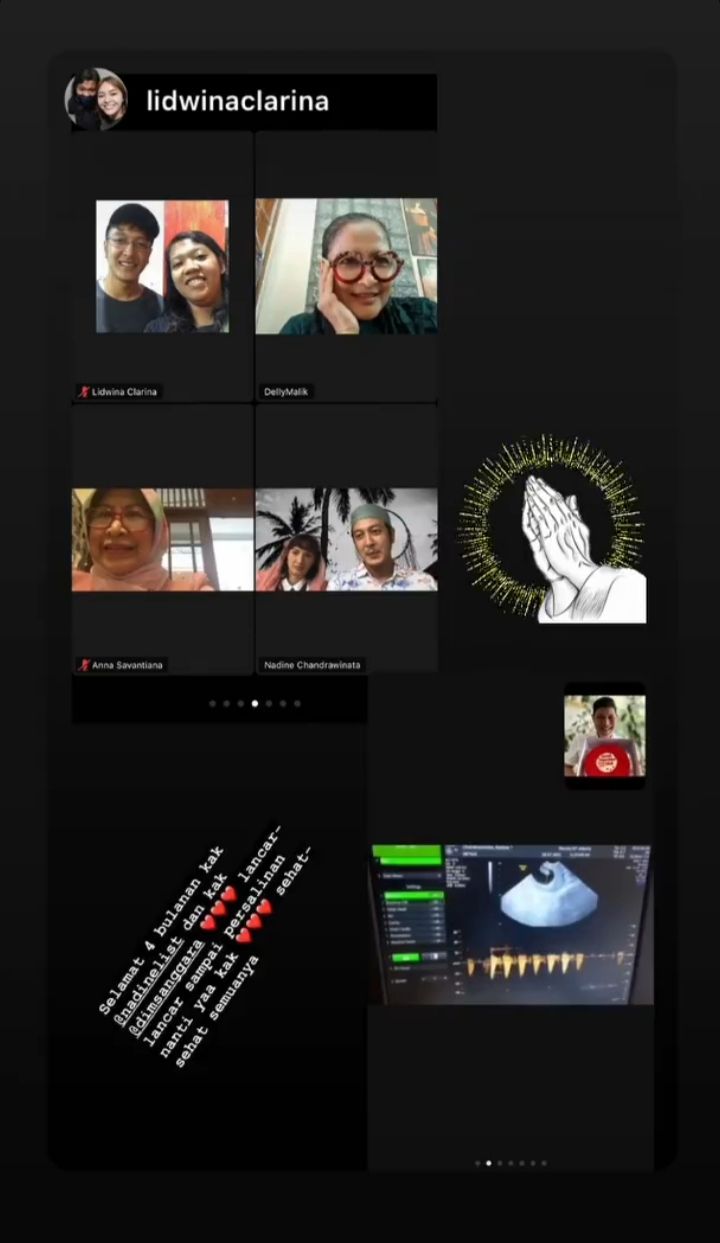 Kabar Bahagia! Potret Nadine Candrawinata Hamil Anak Pertama