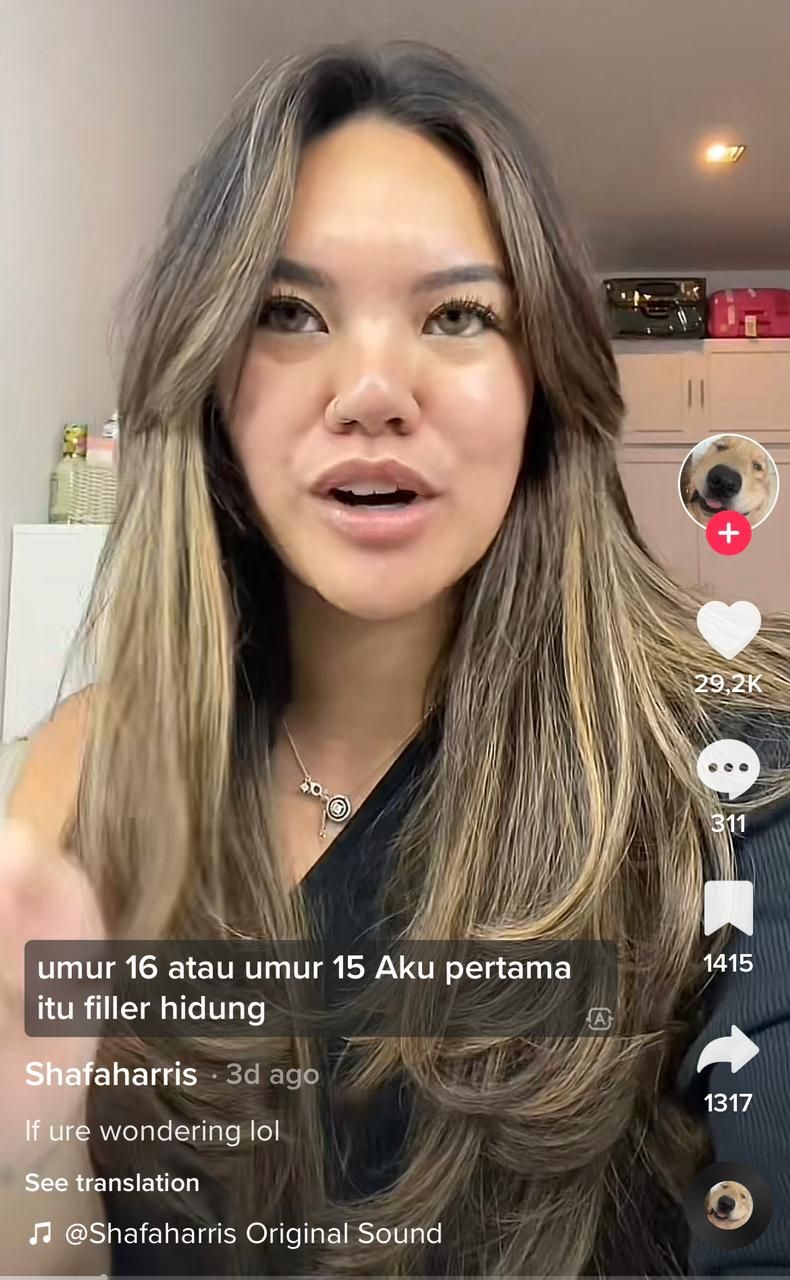 10 Potret Terbaru Shafa Harris, Suntik Filler Sejak Usia 15