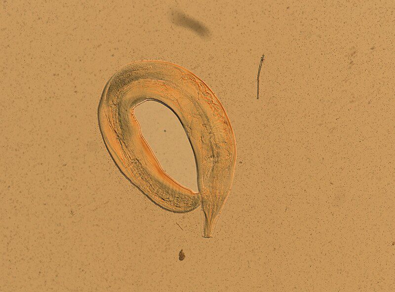 5 Fakta Cacing Kremi, Parasit Tubuh Manusia yang Bandel!