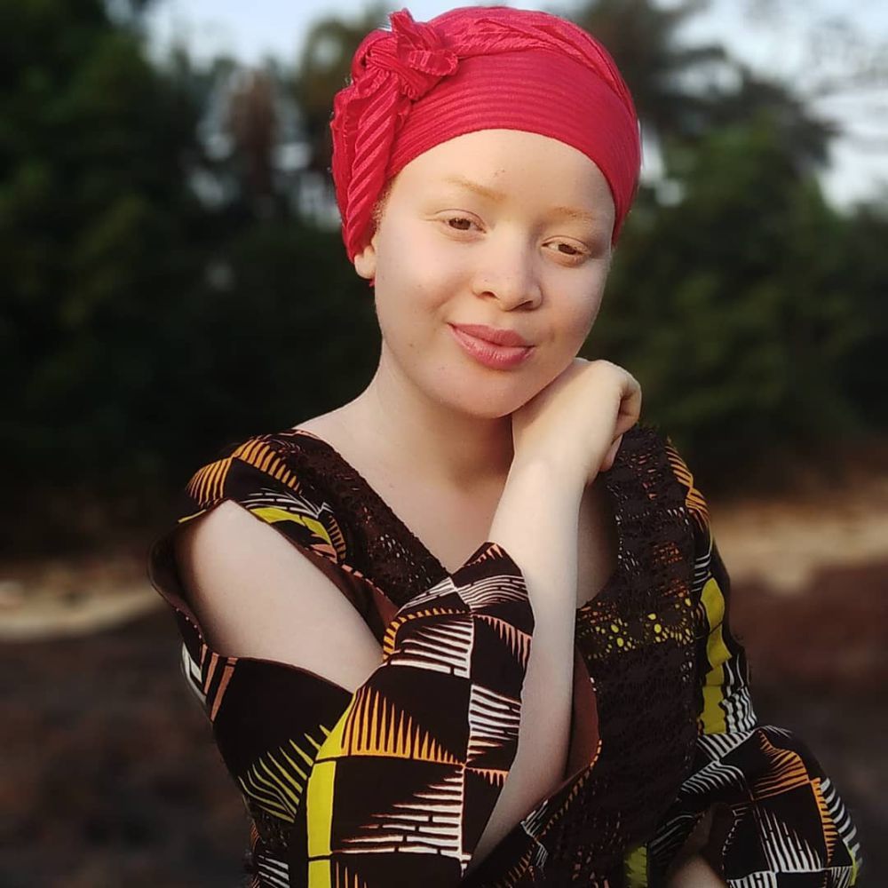 7 Potret Aissatou Diallo Miss Global Guinea 2023 Albino