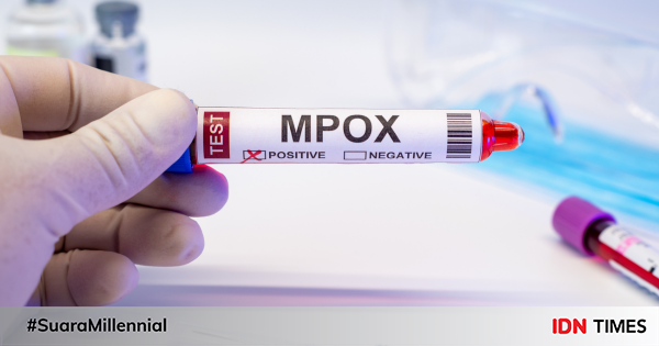 Pemkab Tangerang Siapkan Ruang Isolasi untuk Kasus Mpox