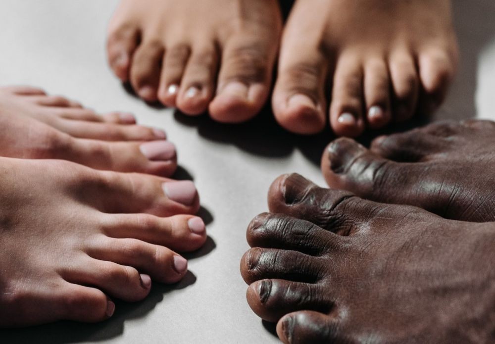 7 Penyebab Kuku Kaki Kuning, Bisa karena Cat Kuku atau Jamur